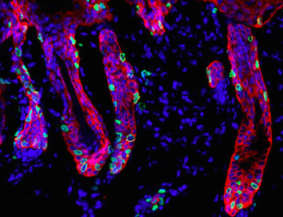 Two awards for the Van Rheenen-lab! - Hubrecht Institute