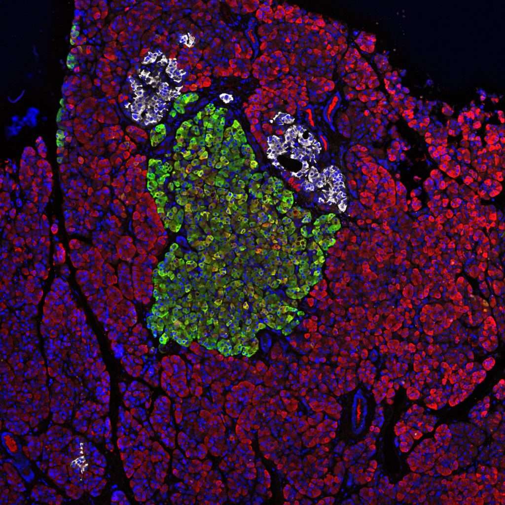 A single-cell transcriptome atlas of the human pancreas - Hubrecht ... A single-cell transcriptome atlas of the human pancreas - Hubrecht ...