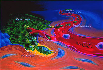PNAS paper about the evolution of colorectal cancer cells - Hubrecht ...