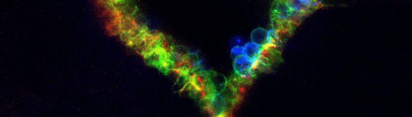 Single-cell transcriptomics reveal the dynamic of haematopoietic stem ...