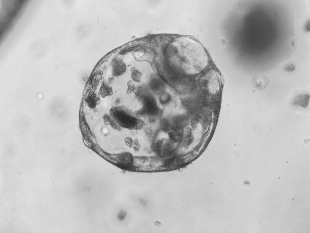 Culturing ovarian cancer organoids - Hubrecht Institute