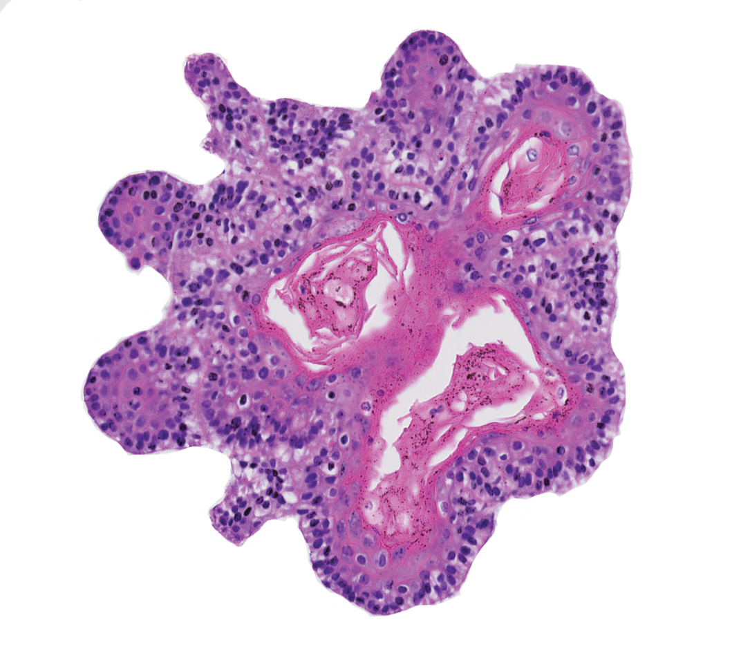 Cancer research using mini-organs from tumors and healthy tissue ...