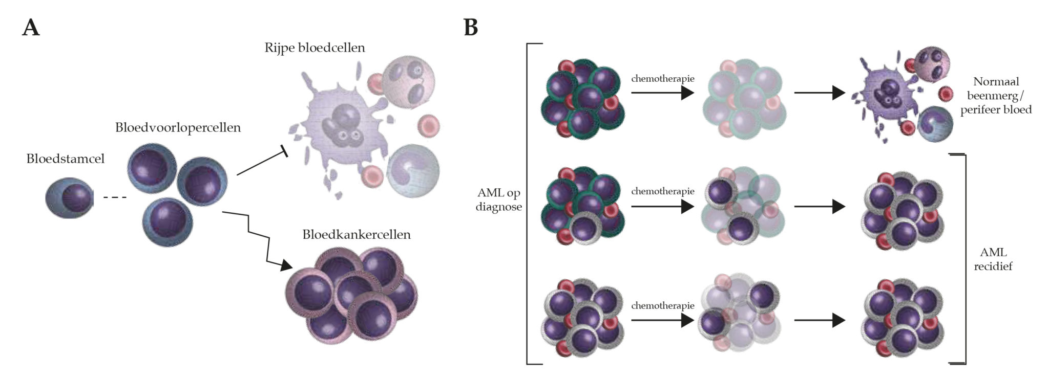 Promotie Caroline Wiggers: Acute myeloïde leukemie tackelen - Hubrecht ...