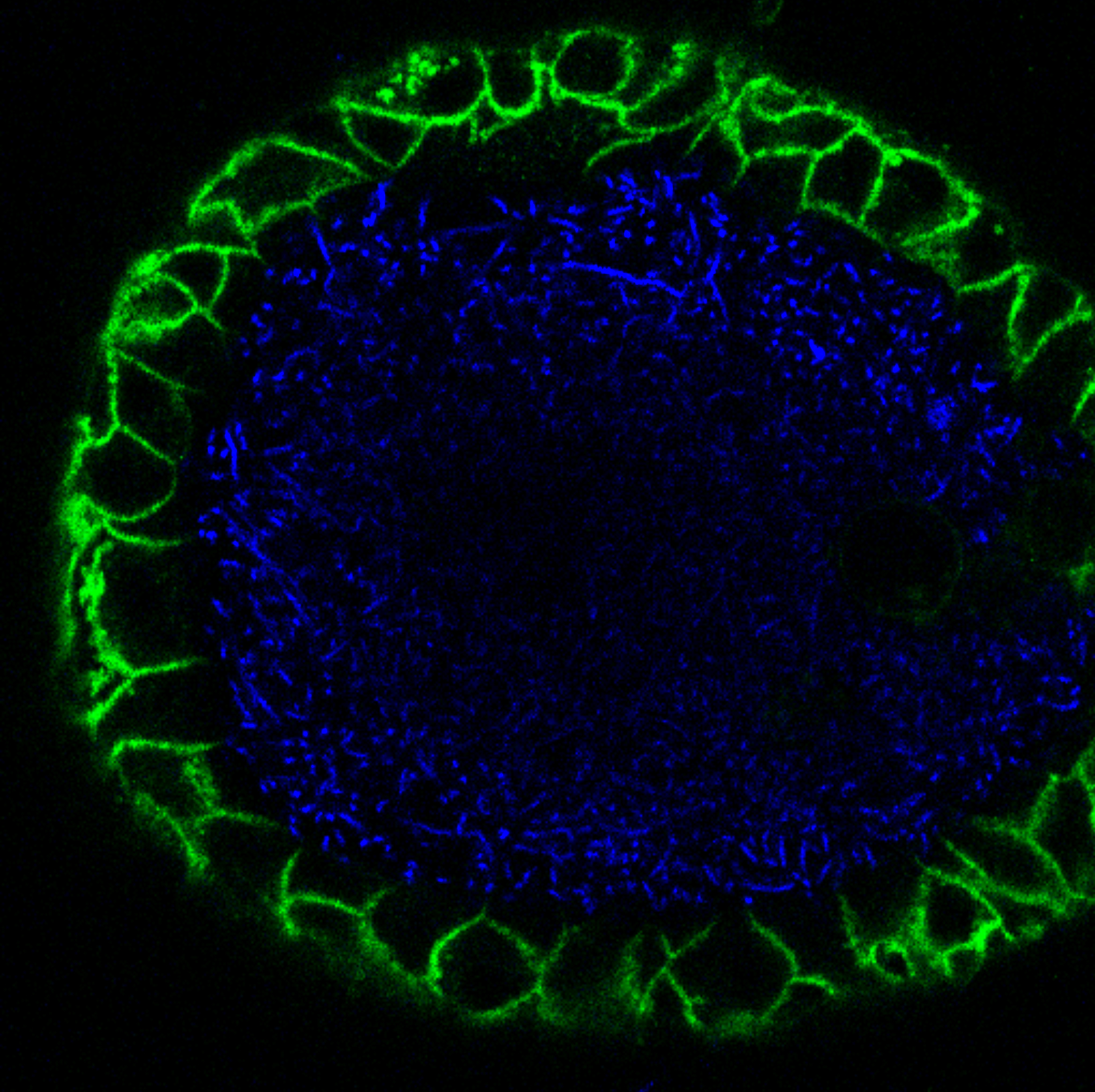 Detection of specific DNA signature colon cancer improved