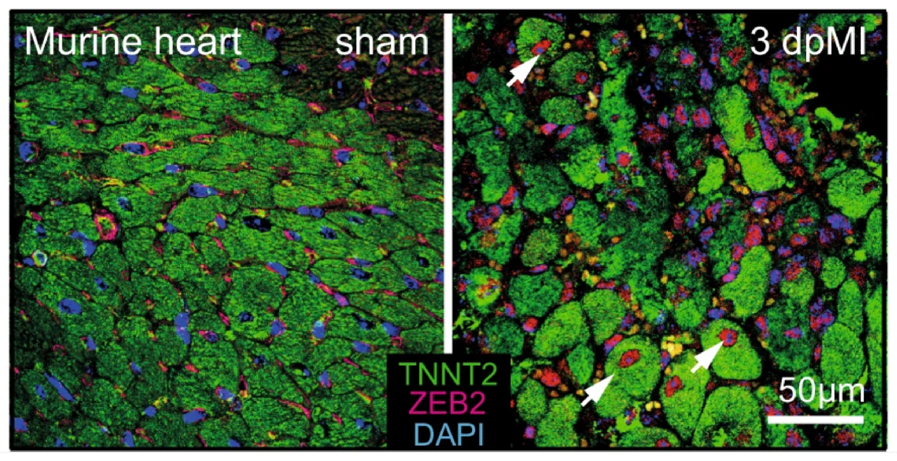 ZEB2 gene improves healing after heart attack in mice