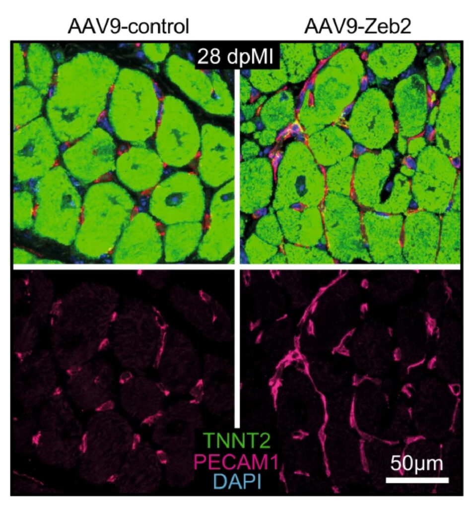 ZEB2 gene improves healing after heart attack in mice