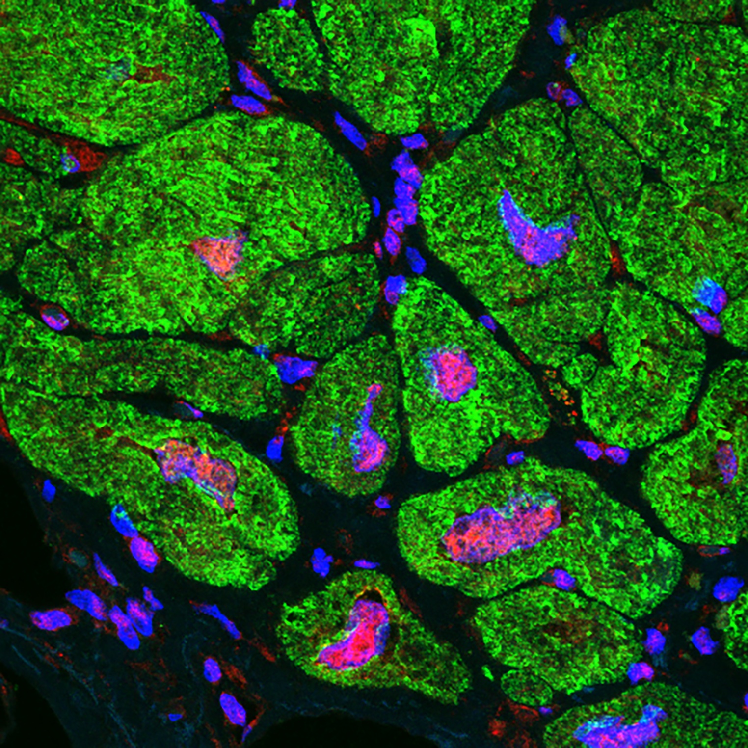 ZEB2 gene improves healing after heart attack in mice