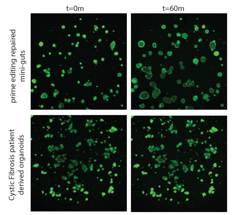 New CRISPR/Cas9 technique corrects cystic fibrosis in human stem cells