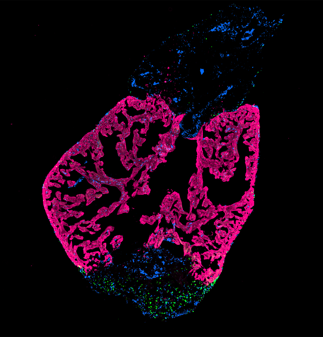 New insights into heart regeneration after injury in zebrafish