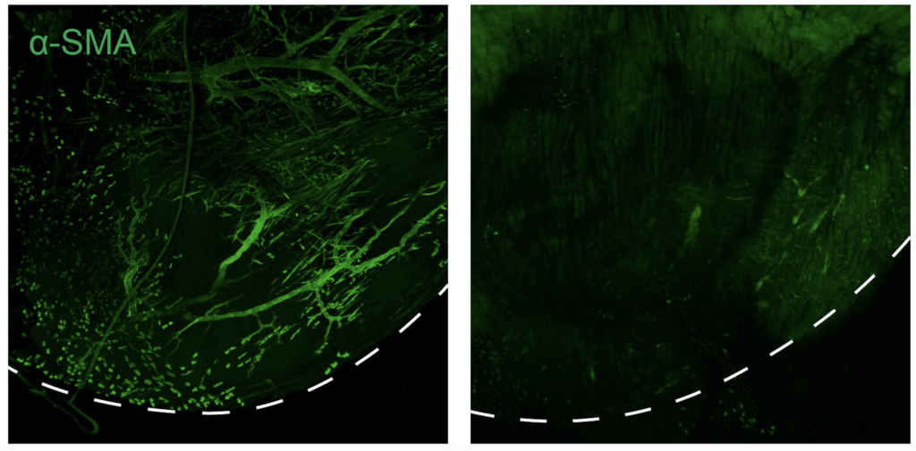 Spiny mouse as a model for heart repair after injury
