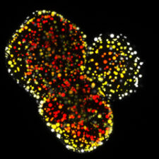 Novel organoid models to study non-alcoholic fatty liver disease