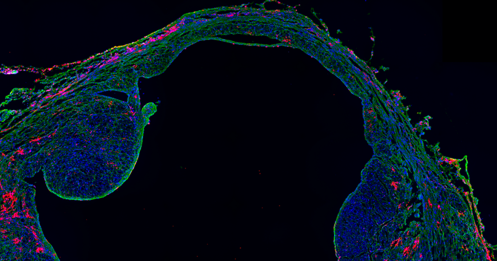 ERK signalling is a switch between regeneration and scarring