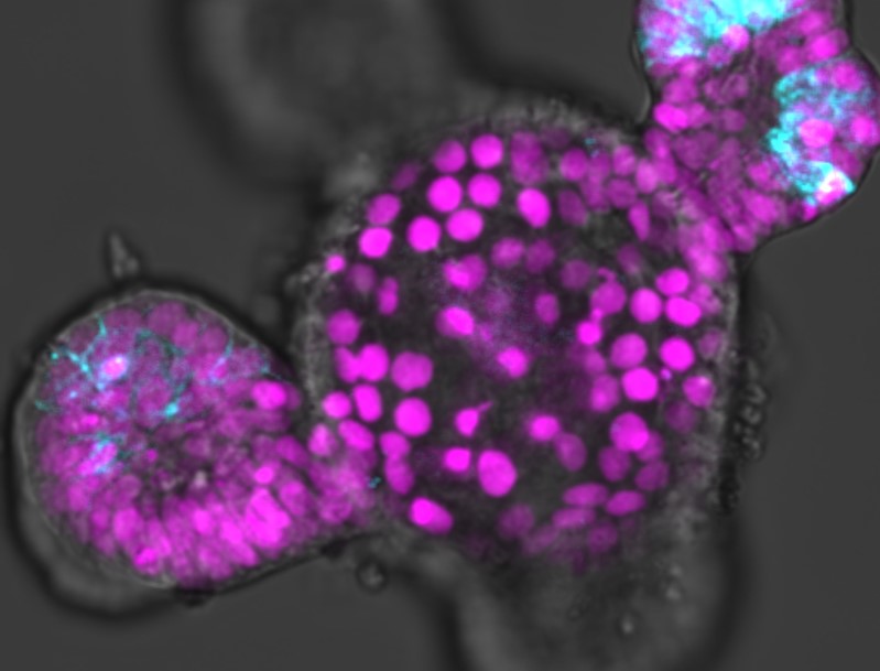 How do stem cells choose their identity?