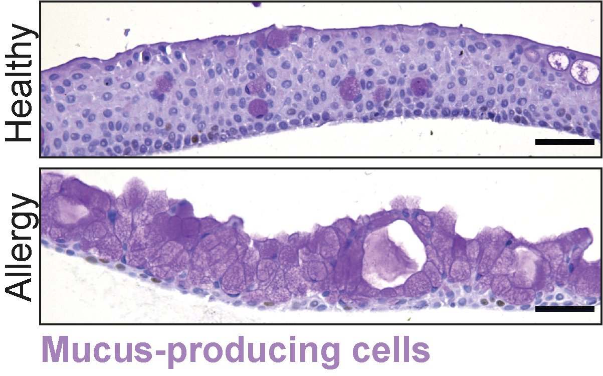 Researchers develop first model of human conjunctiva