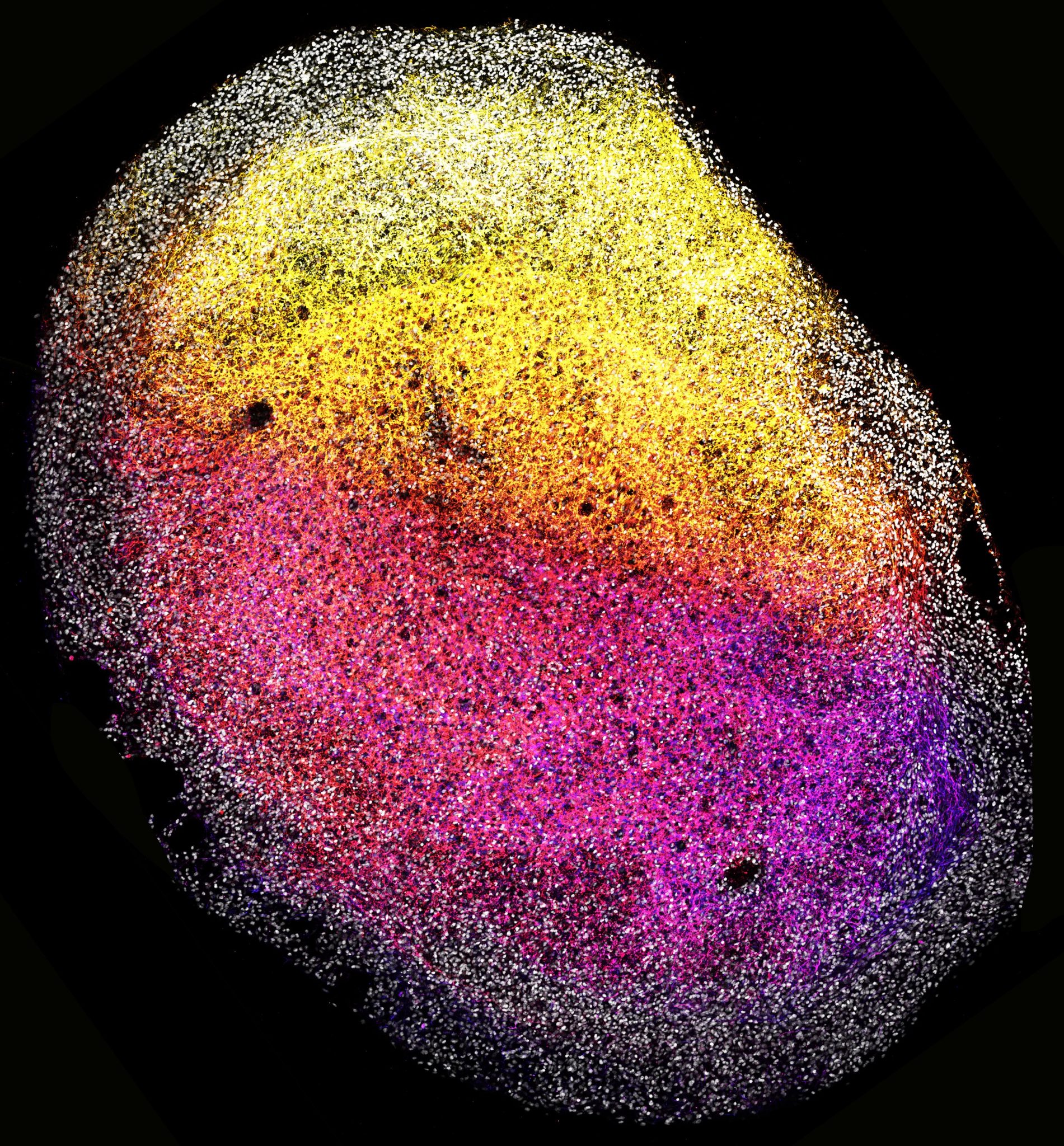 Novel brain organoids could revolutionize brain research