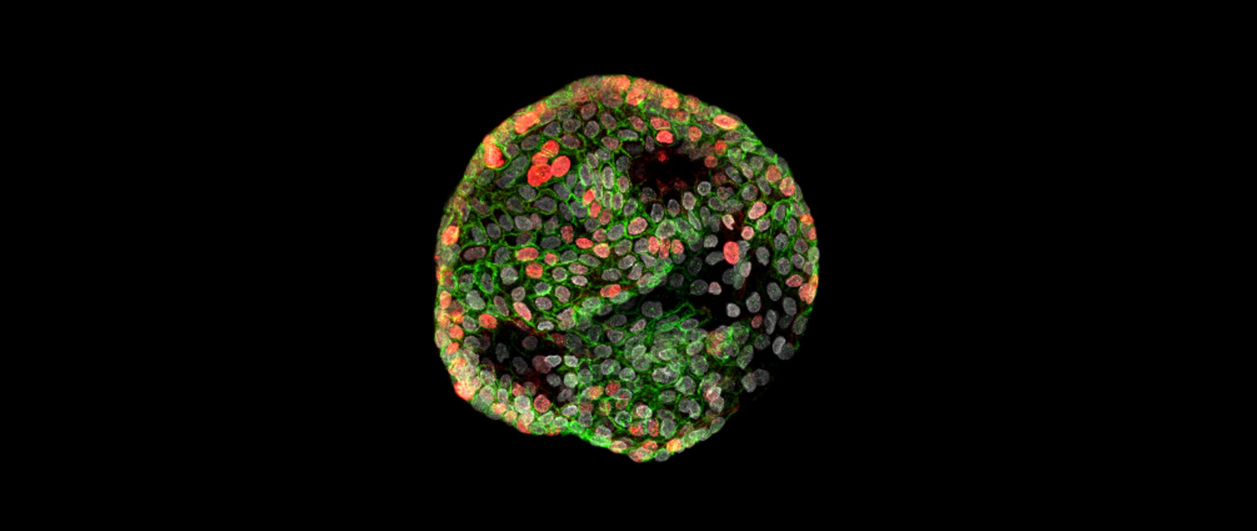 New link between colorectal cancer mutation and EGFR signaling