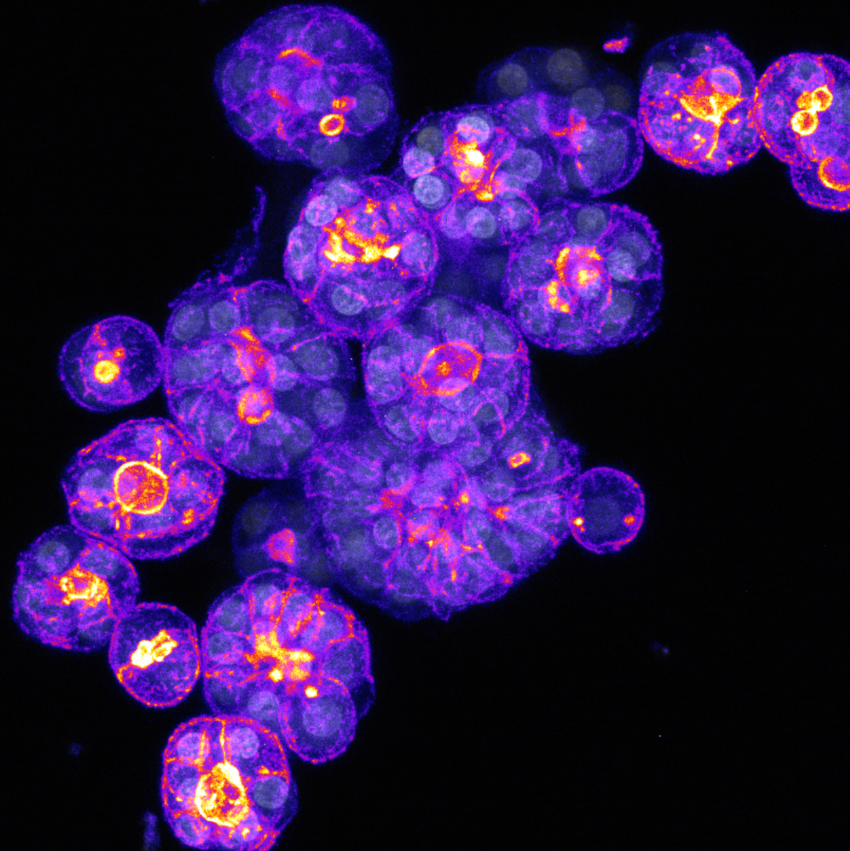 Dutch Cancer Society Grant to study fatty liver and liver cancer