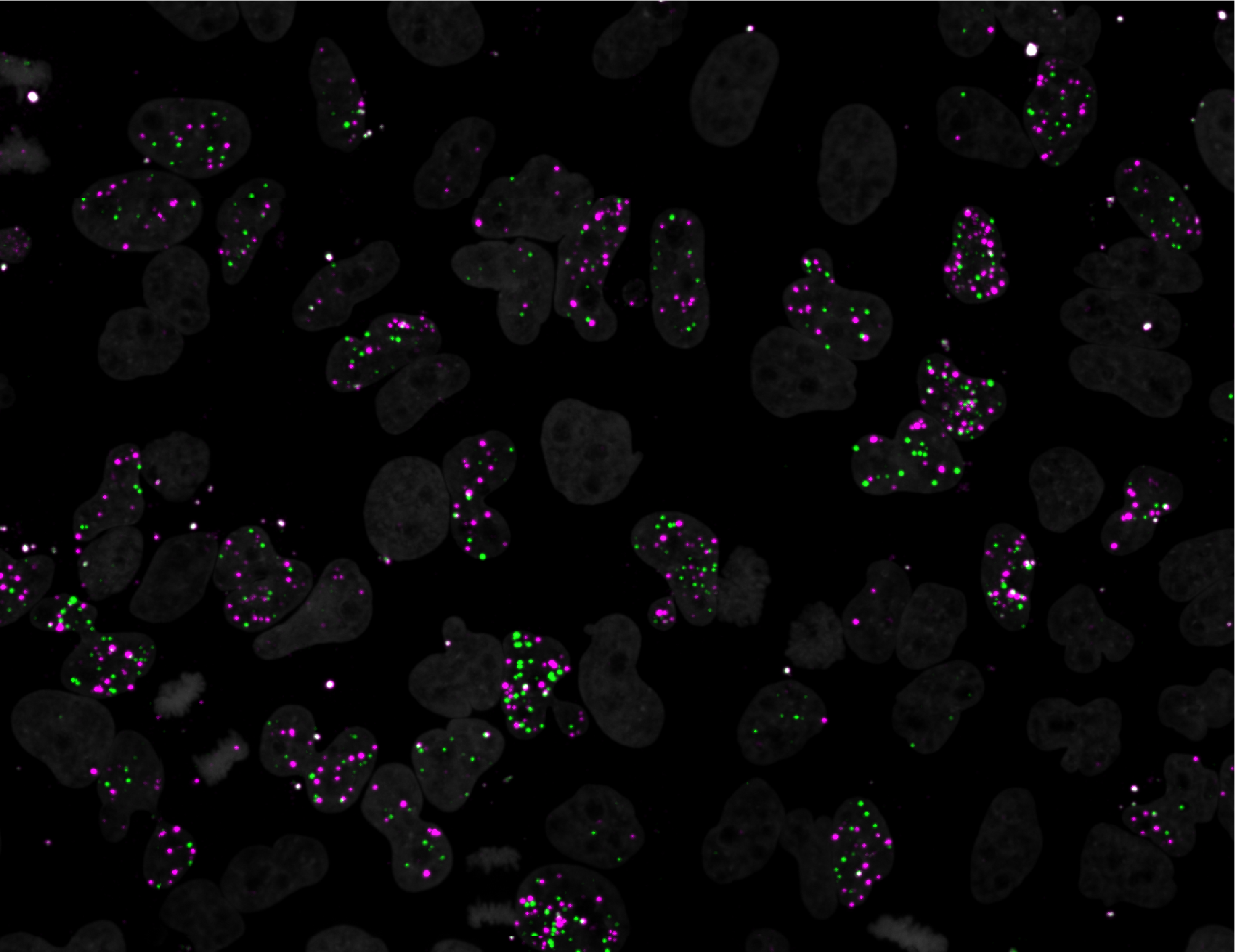 EMBO Postdoctoral Fellowship for Bernhard Kramer