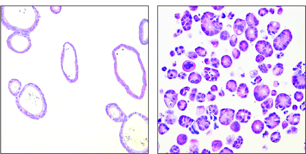 New organoid model to study the origin of colorectal cancer