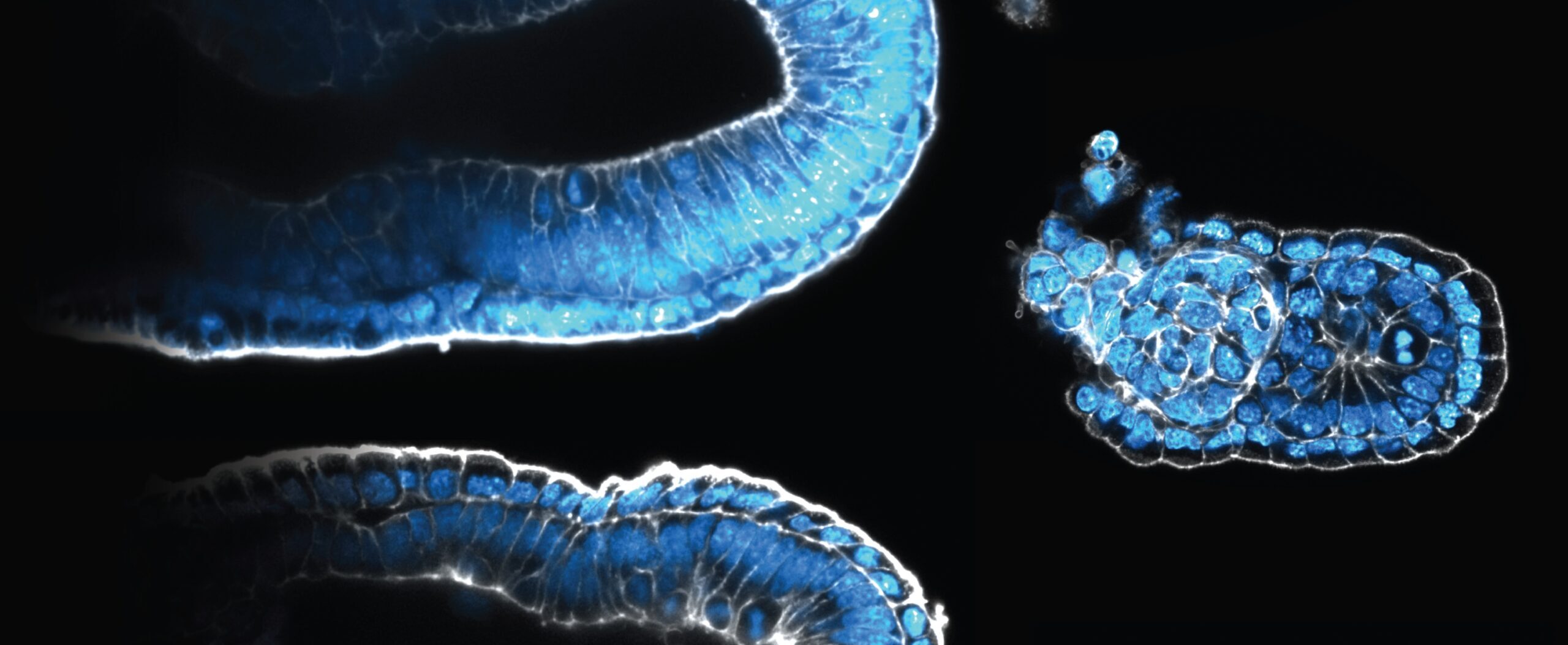 Registration open for Hubrecht Symposium 2025 - Hubrecht Institute