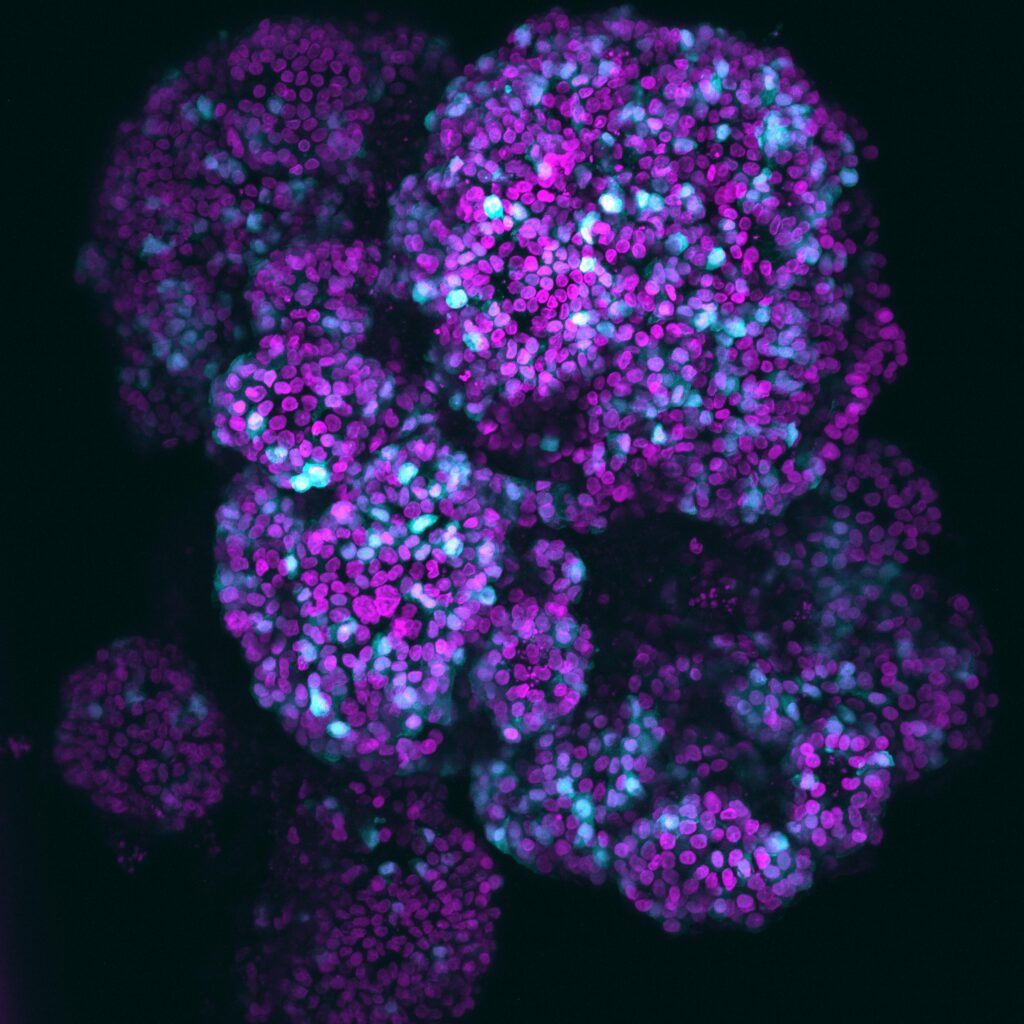 Researchers create a new organoid with all key pancreas cells ...