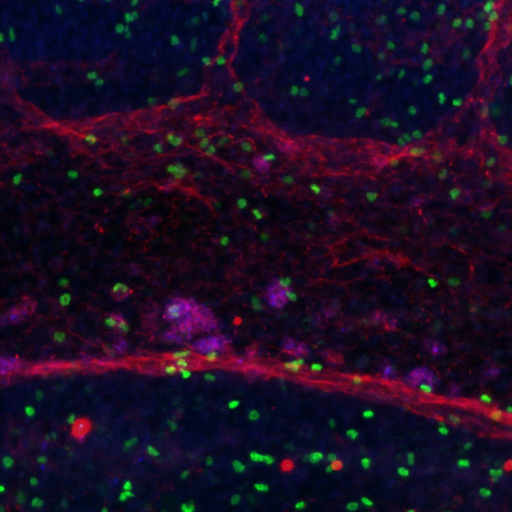 Catherine Robin receives donation to develop personalized blood stem cells